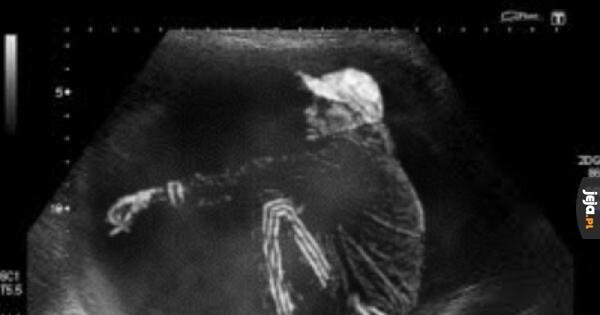 Brajanek w łonie matki - Jeja.pl